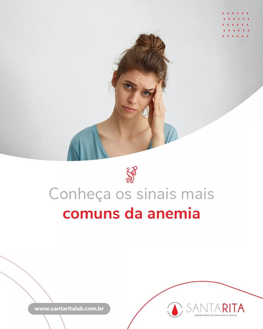 Conheça os sinais mais comuns da Anemia - Laboratório Santa Rita